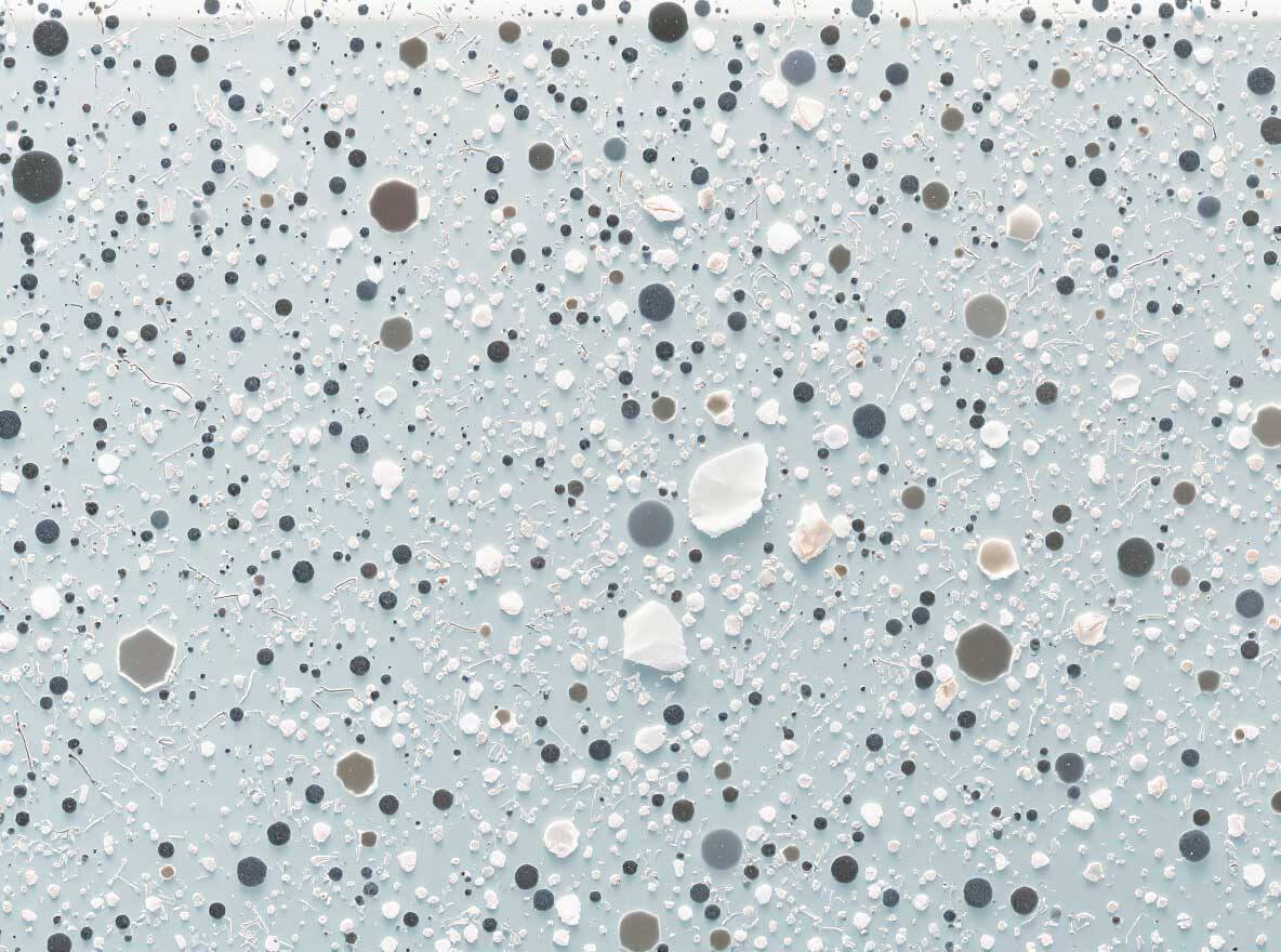 Microplastics in Human Tissues: Health Risks, Chronic Diseases, and ...